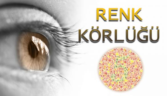 Renk körü olan kişi polis olabilir mi?